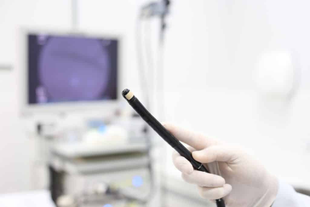 Ecoendoscopia define localização e extensão de tumores - Vida VG